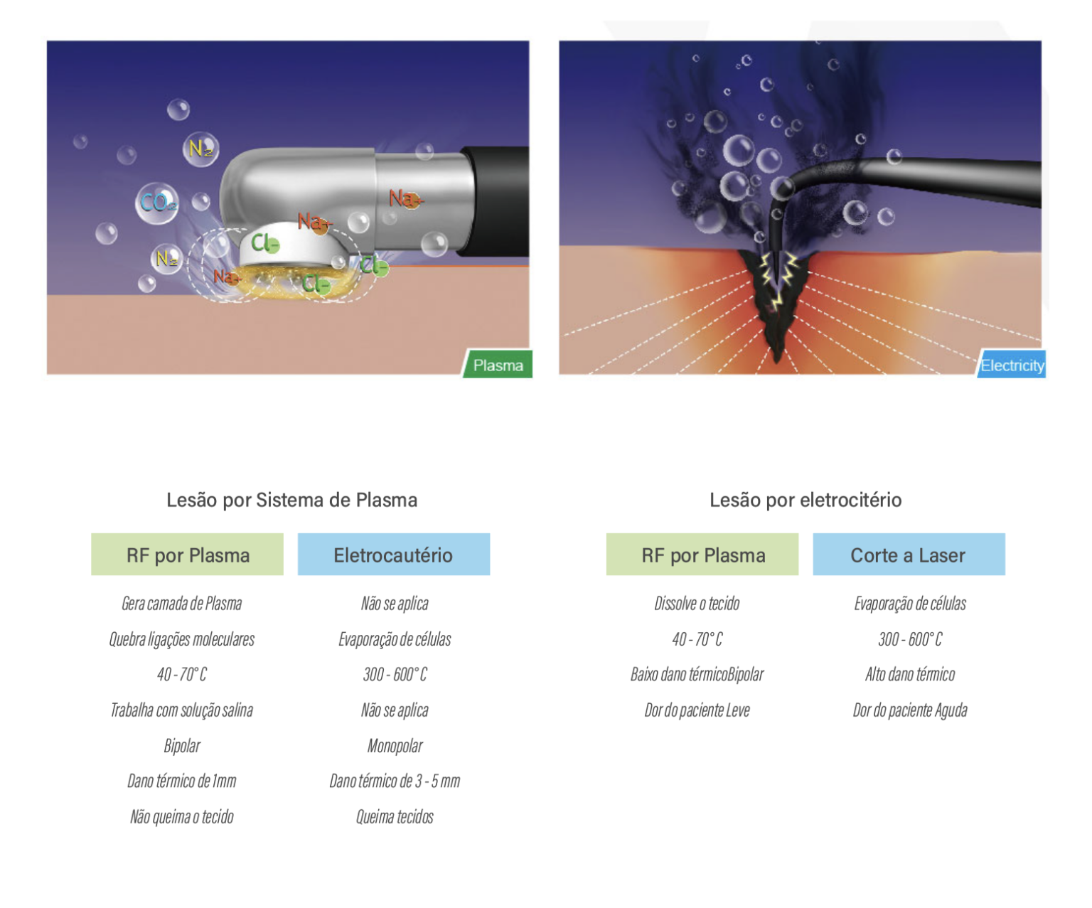Ponteira de Plasma para Artroscopia da ATM - Surgical Line